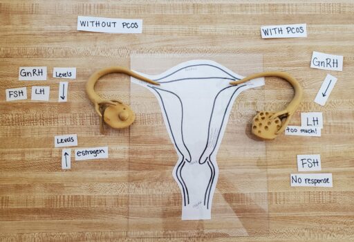 Follicular, Ovulatory, and Luteal Phases with and without PCOS: A model ...